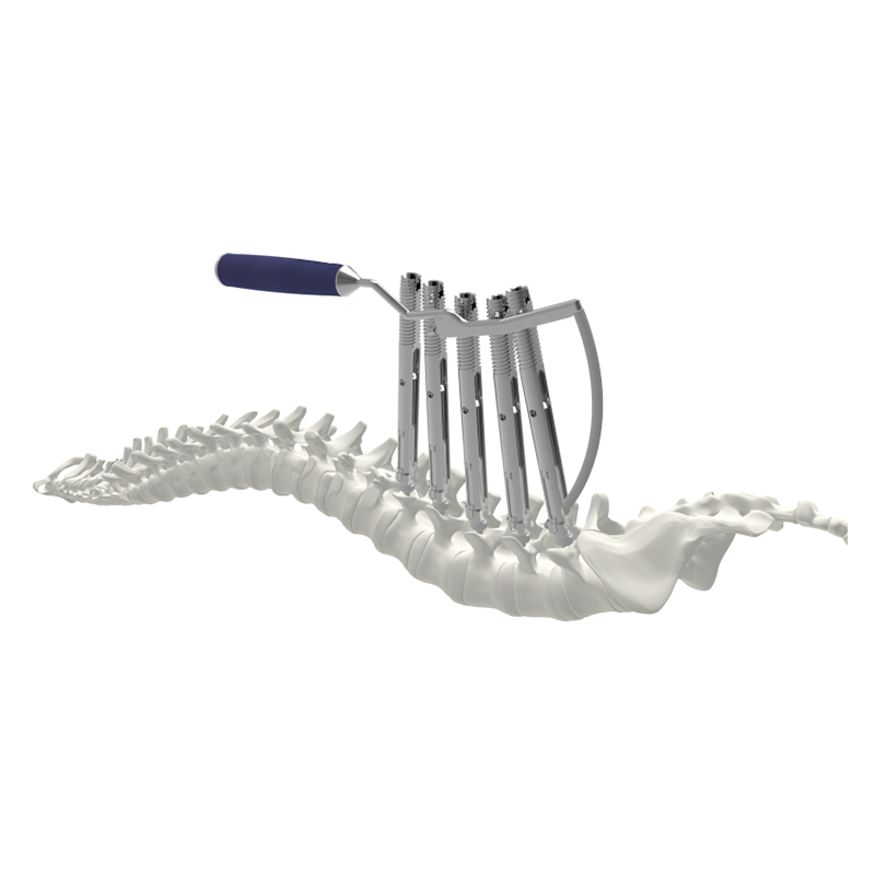 Thoracolumbar Rod System - MIS