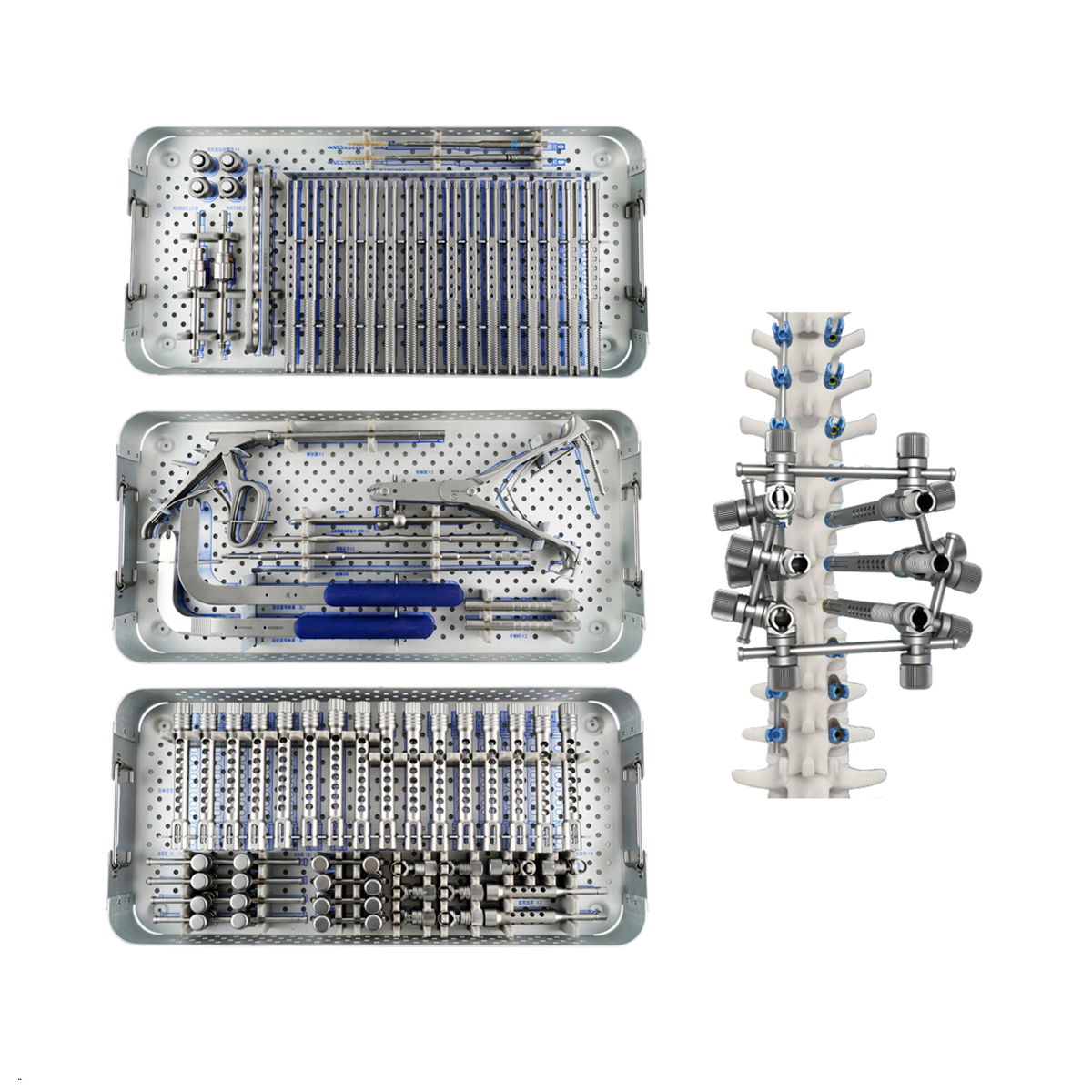 4.75 Spinal Deformity Correction Instrument Set (Ti)